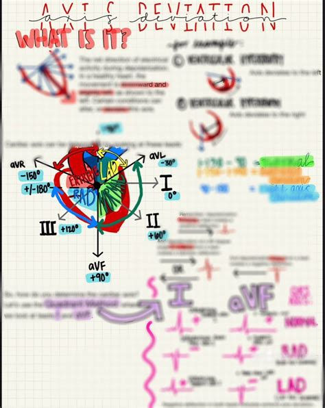 Axis Deviation Cheat Sheet Etsy
