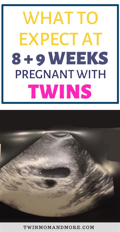 Twin Pregnancy Weeks 8 And 9 What To Expect Twin Mom And More