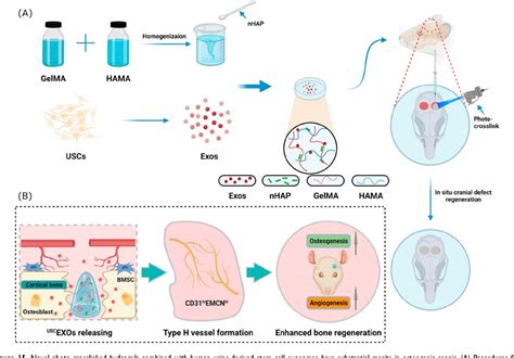 Figure 1 From Engineered Exosomes And Composite Biomaterials For Tissue
