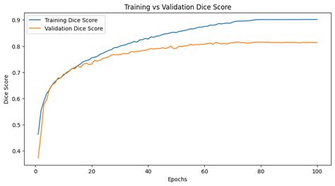 Image Segmentation With U Net In Pytorch The Grand Finale Of The Autoencoder Series Pyimagesearch