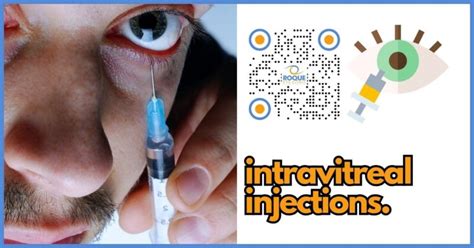 Understanding Intravitreal Injections A Comprehensive Guide For Patients