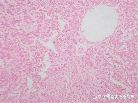 切片学习 常规病理组织切片及诊断要点 知乎