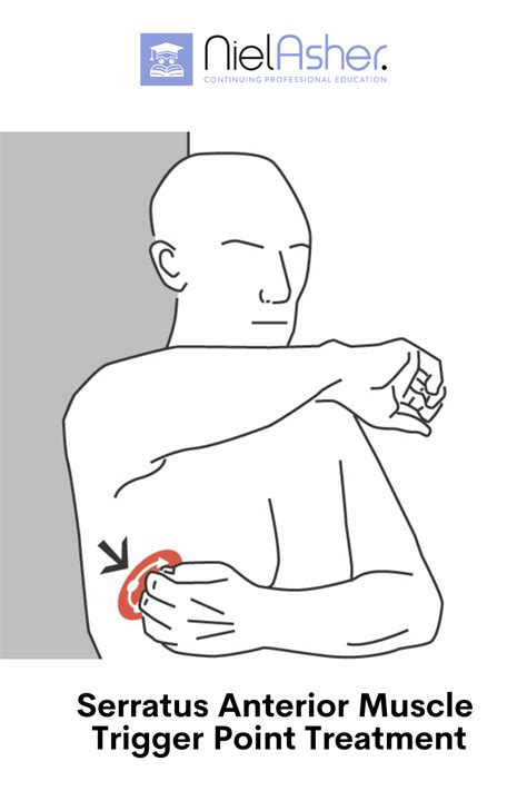 Serratus Anterior Muscle Self Help Trigger Point Treatment Artofit