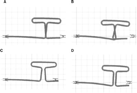 Schematic Representation Of The T Loop Generated By The LOOP Computer Download Scientific