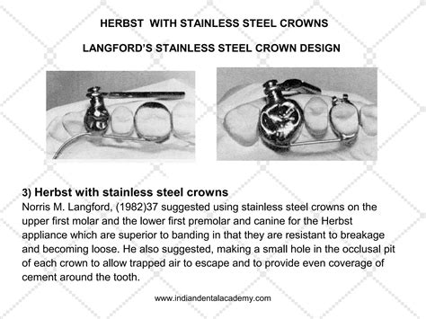 Fixed Functional Appliances Ppt