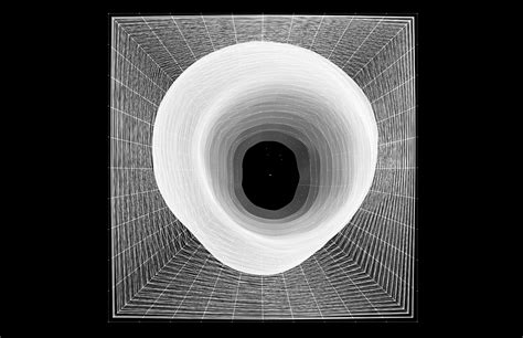 Prosthetic Socket Nomadicform