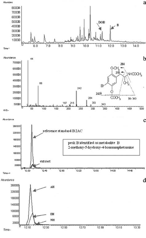 Gc Ms Of Extracts Of Human Urine Obtained After Acetylation A Total