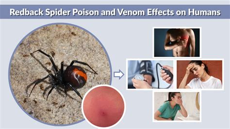 Redback Spider Poison And Venom How Poisonous Is The Redback Spider