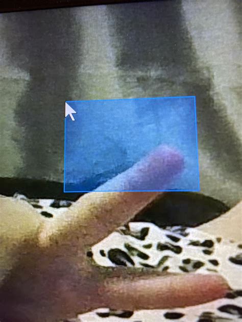 Mouse Cursor Problem Hp Support Community 9051098