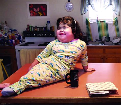 انسان‌هایی که نقص جسمی باعث شباهت آنها به حیوانات شده است