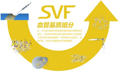 嘉思特医疗器材天津股份有限公司