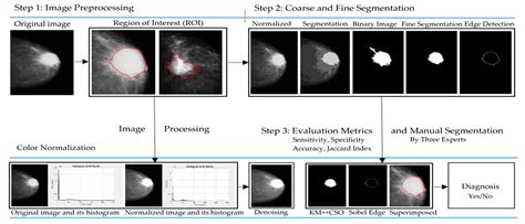 Breast Cancer Detection In Mammogram Images Using Kmeans Clustering