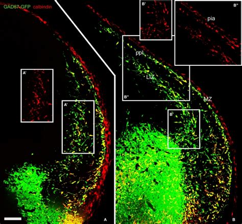 Calbindin Labeled Migratory Gabaergic Interneurons In The E135 Mouse