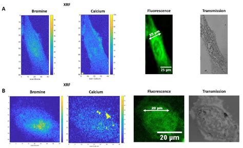 X Ray Fluorescence Maps Of Bromine And Calcium Normalized To 1 S Pixel
