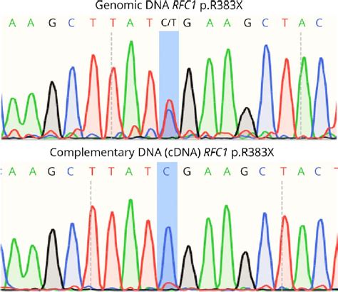 Sanger Sequencing Files Of The Rfc1 Cc1147t Pr383x Variant Location