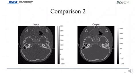 Denoising Unpaired Low Dose Ct Images With Self Ensembled Cyclegan Pptx Computing