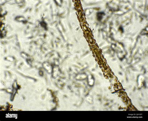 Phytophthora Infestans Microscope