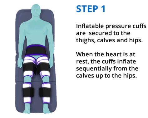 How Ecp Works Renew Ecp