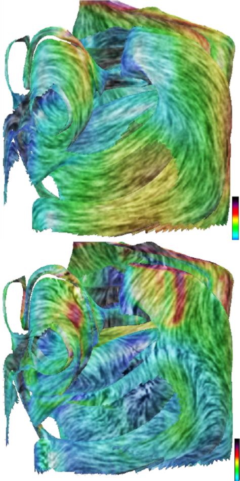A Hybrid Stream Surfacetexture Advection Visualization The Tumble Download Scientific Diagram