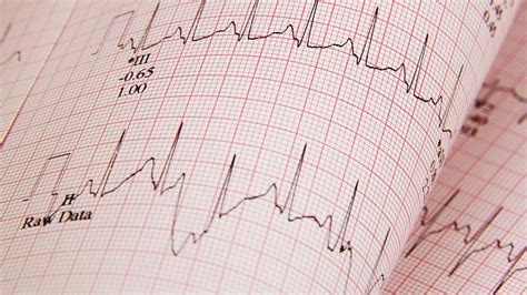Human Physiology Cardiac Output And Factors Affecting Cardiac Output YouTube