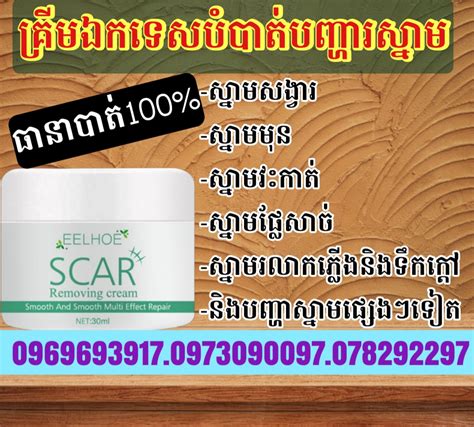 ដំណោះស្រាយសុខភាពនិងសម្រស់ 061 39 59 03 សែលកាត 0714486 763 មិតហ្វូន 096 251 7082 ស្មាត