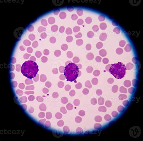 Basophil Under Microscope