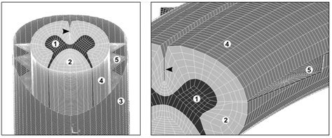 Finite Element Model Of The Human Cervical Spinal Cord Left Side Download Scientific Diagram