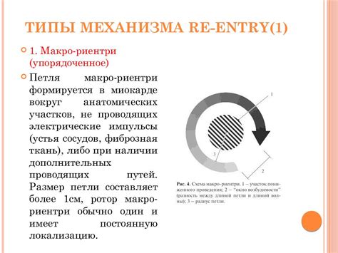 Тахикардия по механизму Re Entry — презентация