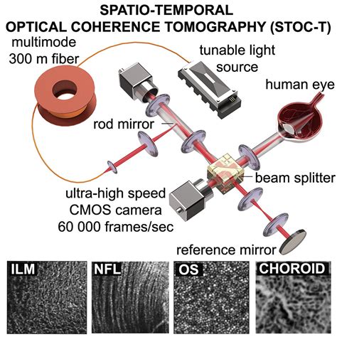 Spatio Temporal Optical Coherence Tomography Provides Full Thickness Imaging Of The