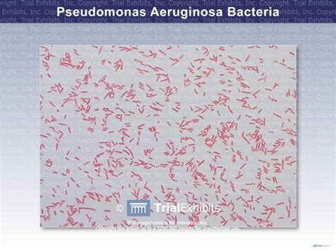 Pseudomonas Aeruginosa Bacteria Trialquest Inc