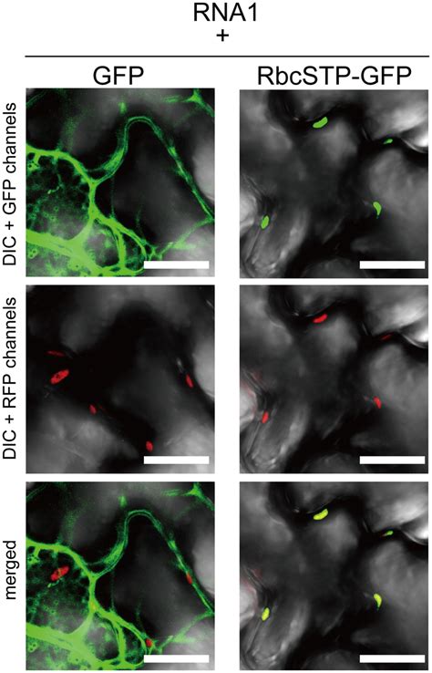 Subcellular Localization Of Free Gfp And Gfp With Chloroplast Targeting