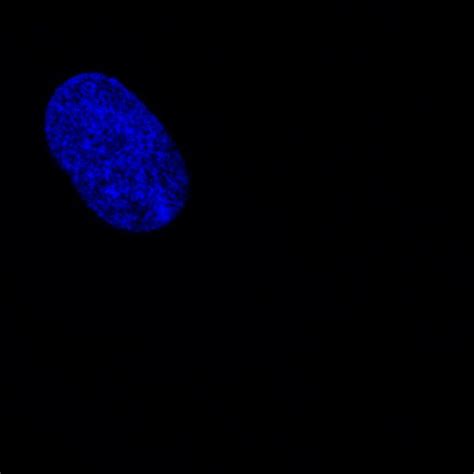 Can Someone Identify The States Of The Cell Based On The Following Dapi Images Researchgate