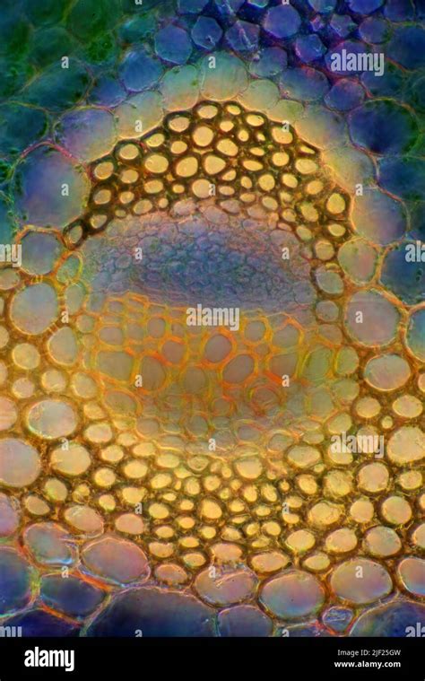 Polarised Darkfield Light Micrograph Of A Transverse Section Through A Vascular Bundle In Dock