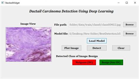 GitHub Karthik S EC Breast Cancer Detection Using Tensorflow With Graphical User Interface