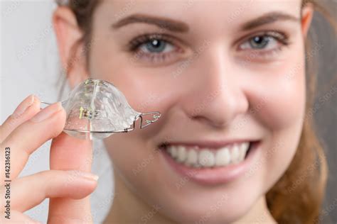 Mädchen zeigt Zahnspange Stock Photo Adobe Stock