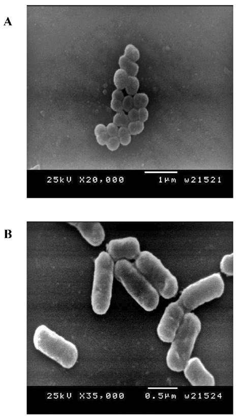 Sem Micrographs Of Two Marine Lab Isolates A Pediococcus And B