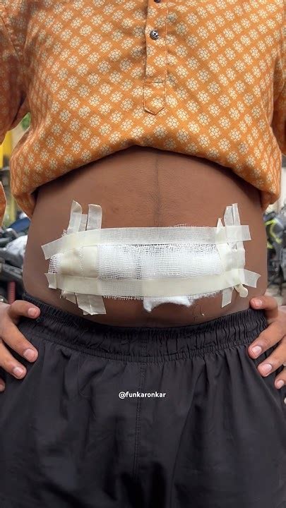 Appendix Appendics Youtube