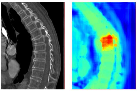 Artificial Intelligence Powers New Era In Radiology