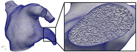 Hemodynamic Simulation In The Left Atrium And Left Atrial Appendage — Vampy