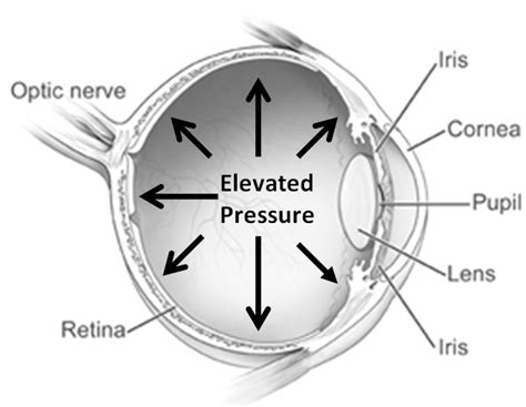 Microfluidic Sensors And Circuits For Internet Of Things Applications IntechOpen