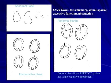 Ppt Managing Dementia In Primary Care From Diagnosis To Driving To Dangerous Medications