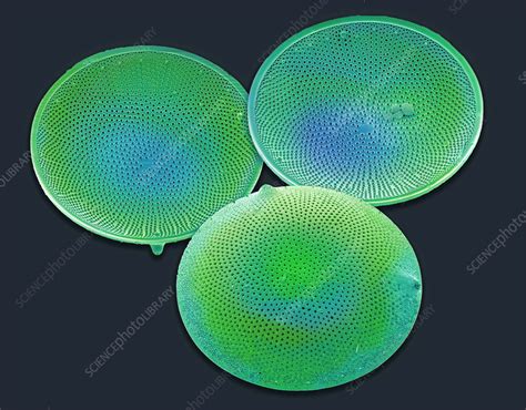 Diatoms Sem Stock Image C059 7849 Science Photo Library