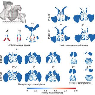Ten Coronal Slices Viewed From The Face Taken In The Anterior Main Download Scientific