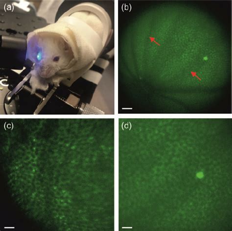 Two Photon Imaging Of The Rpe In Living Wt And Rpe65 Mice A