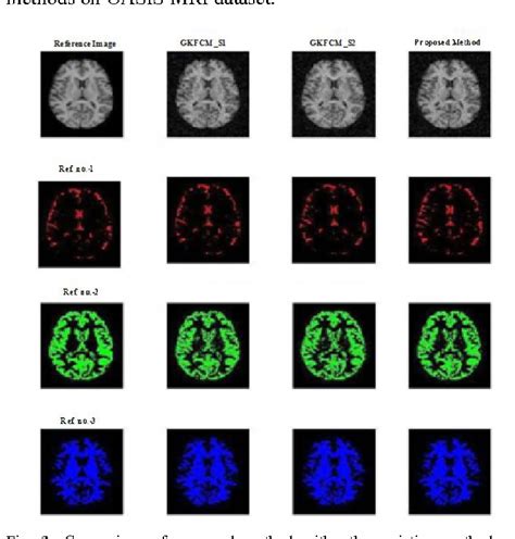 Figure 2 From Performance And Evalution Of Guassian Kernals For Fcm