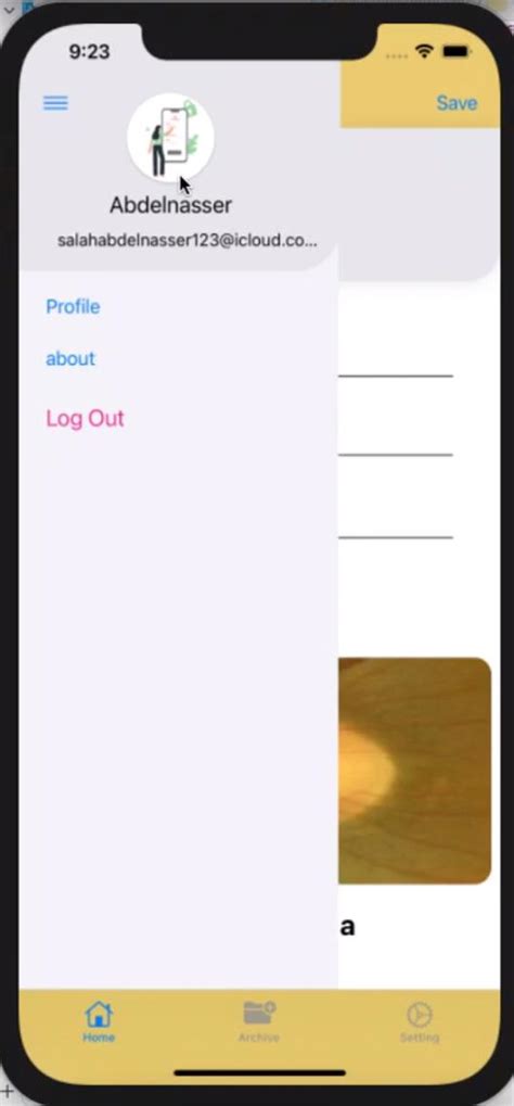 Github Abdelnasser100glaucoma Detection