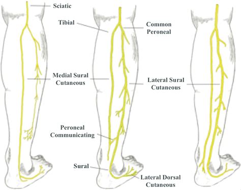 Sural Nerve Clinical Tree