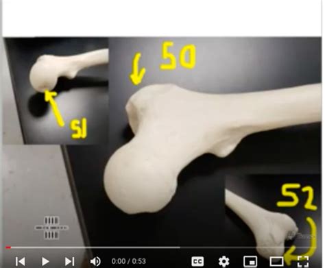 Femur Tibia Fibia Foot Flashcards Quizlet