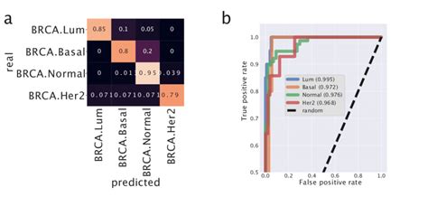 Predictor Model For Breast Cancer We Built A Neural Network And