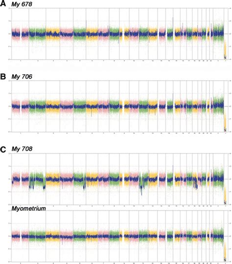 Copy Number Variation Cnv Array Analysis Of Two Leiomyomas Without